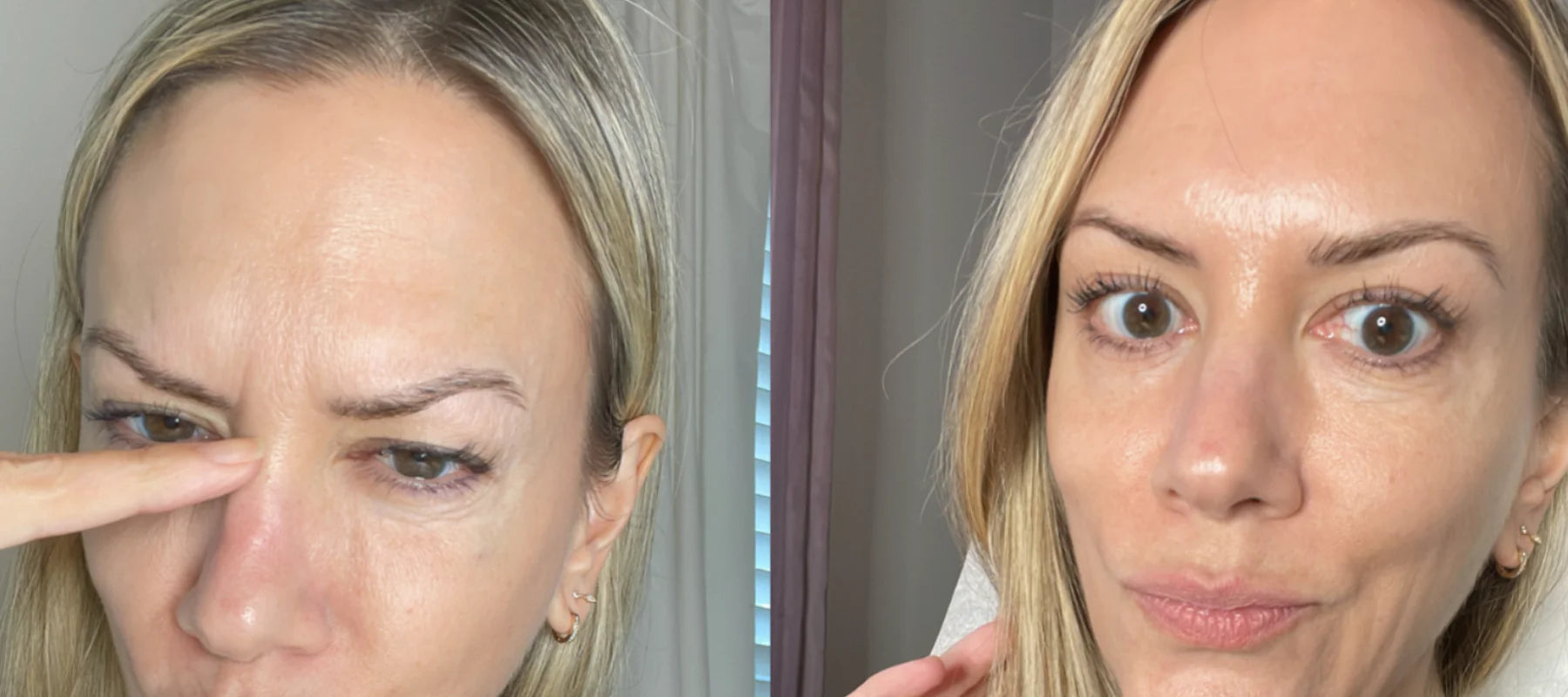 Taping Facial avec Patchs en Silicone de Qualité Médicale | Réduction des Rides - Leaf Cosmetics